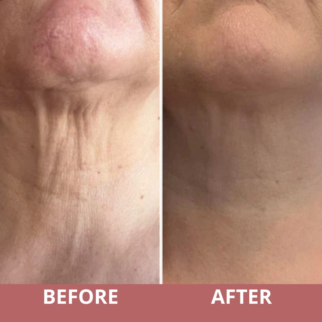 Neck Sculpt Firming Cream – Tighten, Lift & Restore Youthful Skin ...